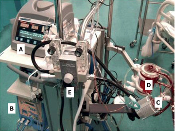 Chapter 29 – Extracorporeal Membrane Oxygenation | Anesthesia Key