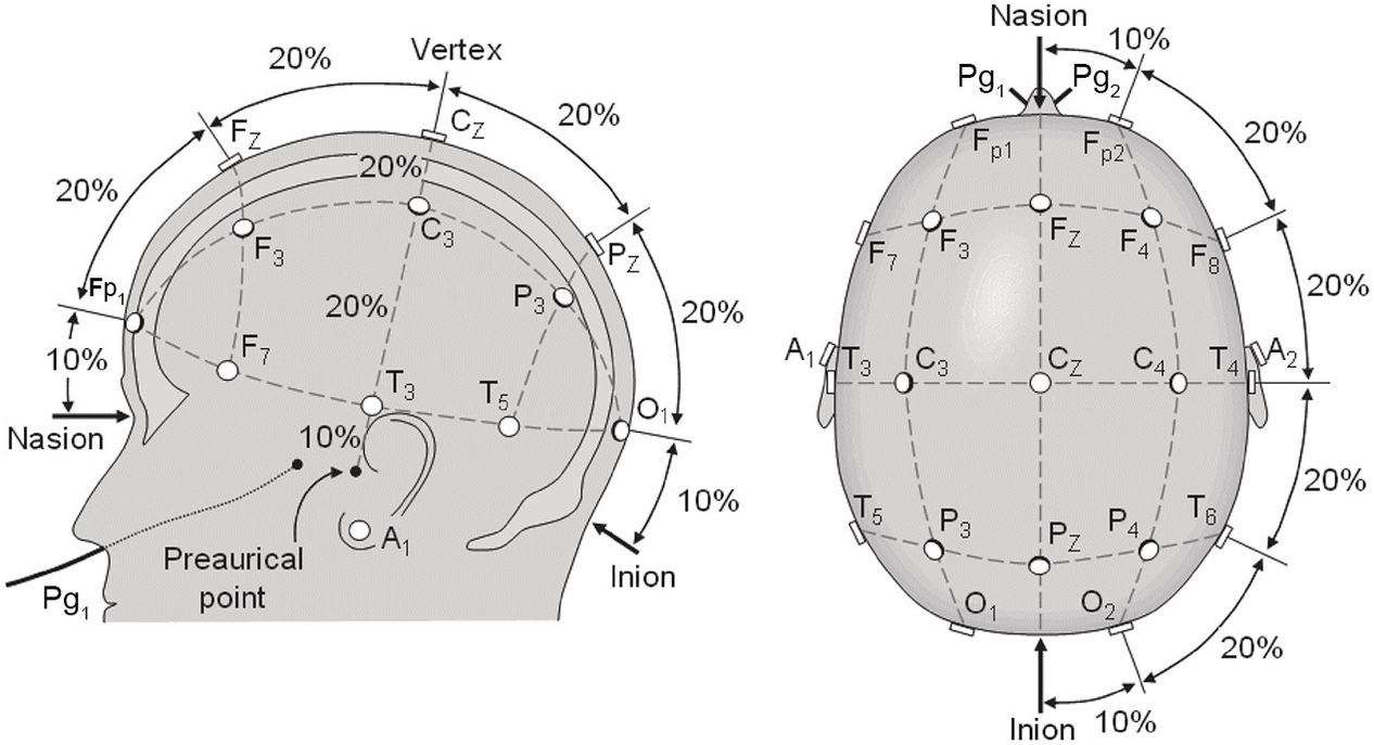 Chapter 31 – Neurological Monitoring | Anesthesia Key