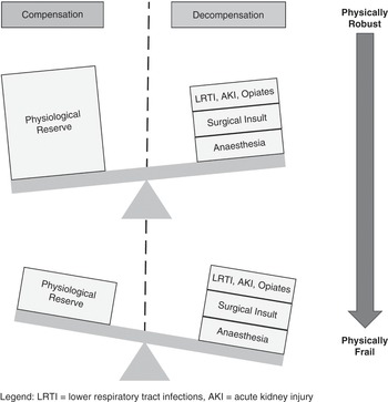 Chapter 14 – Frailty | Anesthesia Key