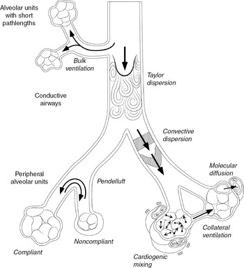 16 – Neonatal Ventilation Strategies | Anesthesia Key