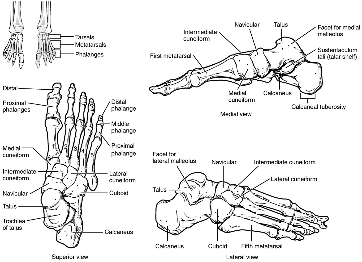 Chapter 20 – Lower Extremity Trauma | Anesthesia Key