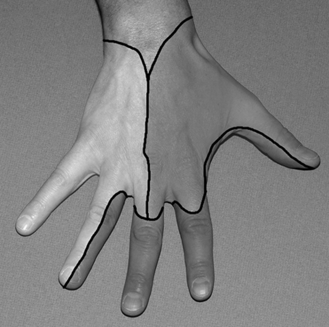 Chapter 1 – Hand and wrist emergencies | Anesthesia Key