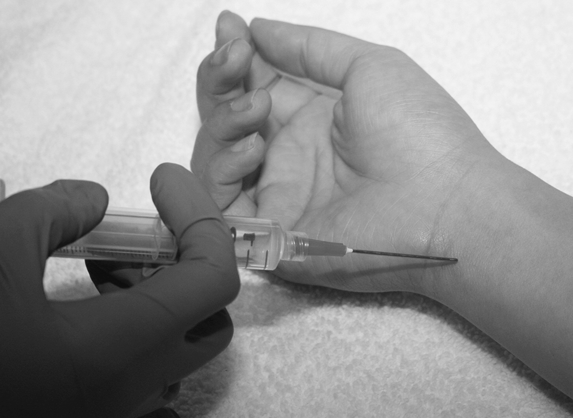 Chapter 9 – Procedures for orthopedic emergencies | Anesthesia Key